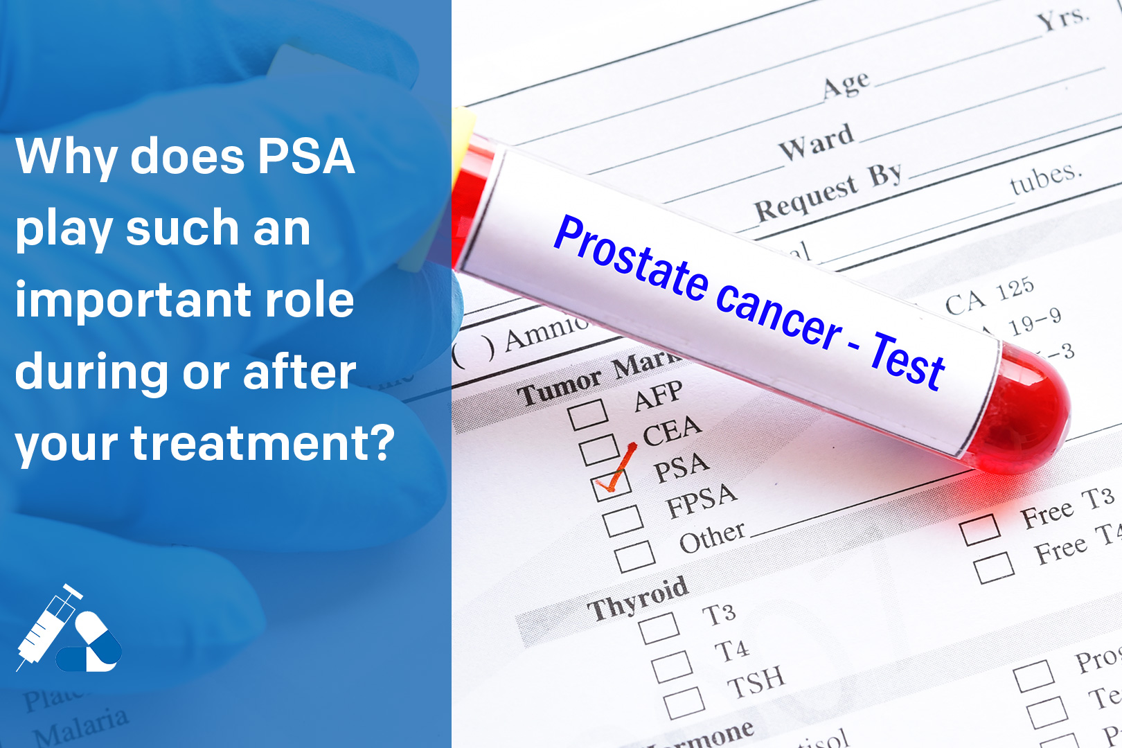 Why does PSA play such an important role during and after your ... Why does PSA play such an important role during and after your ...