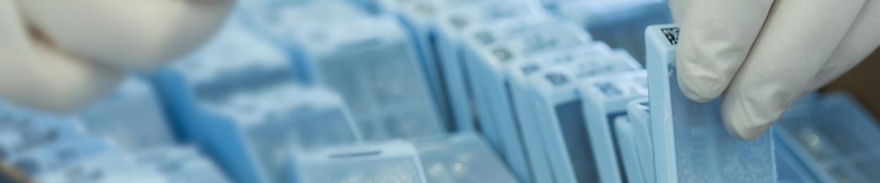 All about biopsy | PROCURE